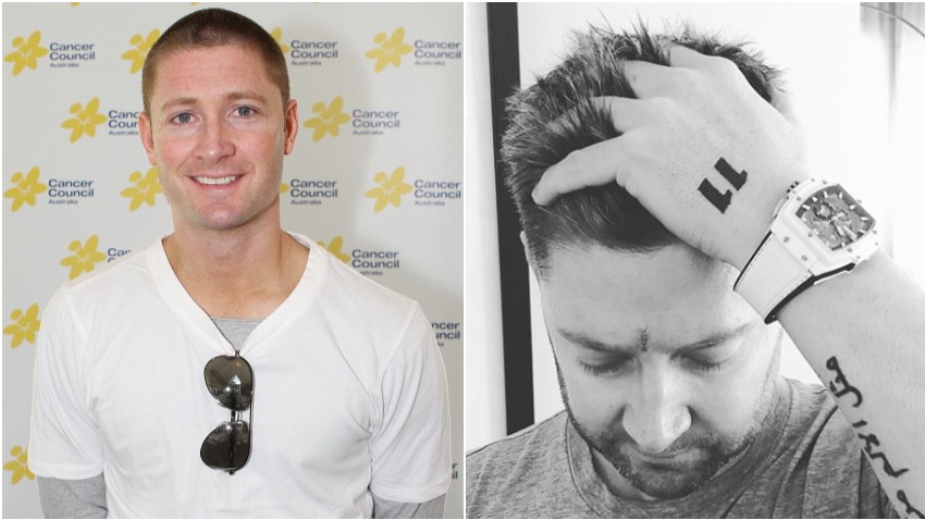 Michael Clarke gets skin cancer removed from his forehead; shares ...